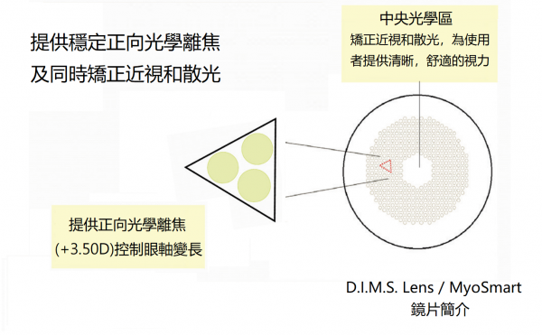 dims lens2 - 視力中心（香港）有限公司